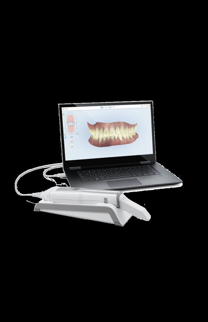 element_scanner | Stanwood Dentist